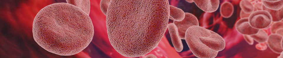 Hematology – New York City – Montefiore Medical Center | Blood ...